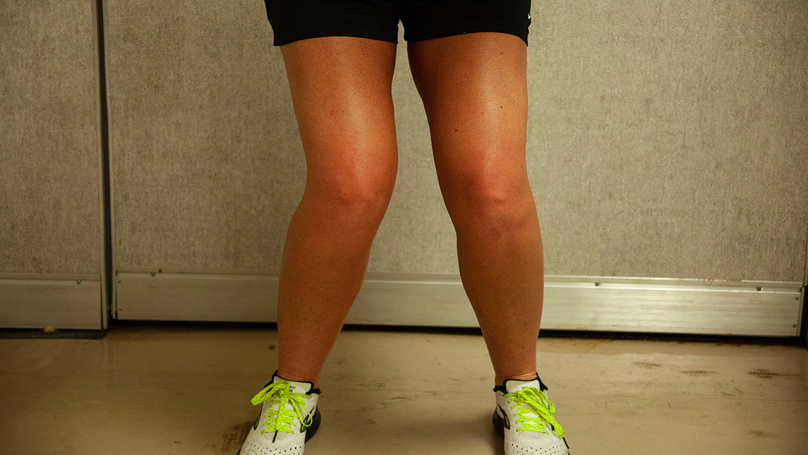 How puberty can impact teens’ knees | UNC Greensboro